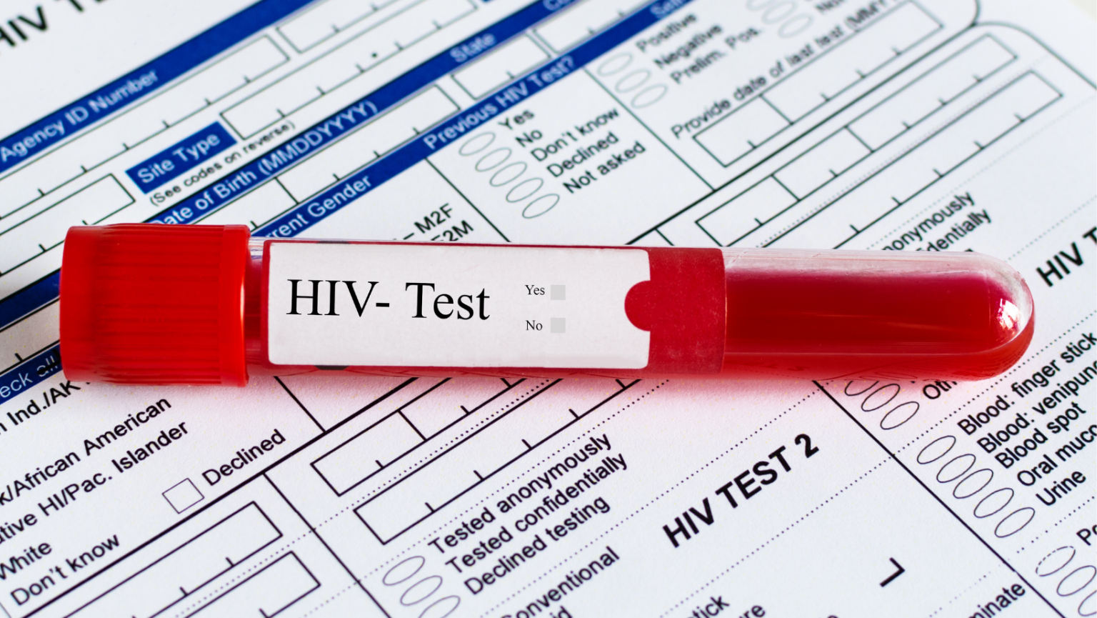 Stay On Top of Your Sexual Health: Top 5 Tests for Sexual Health