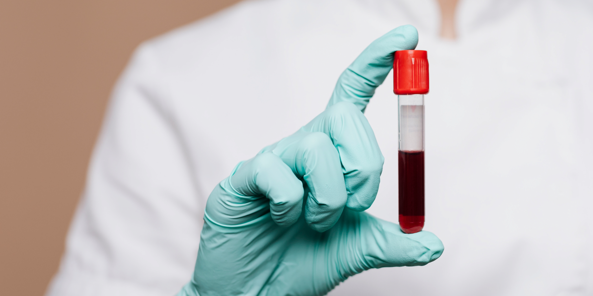 Why Everyone Should Get Tested For STIs Regularly - DrSafeHands